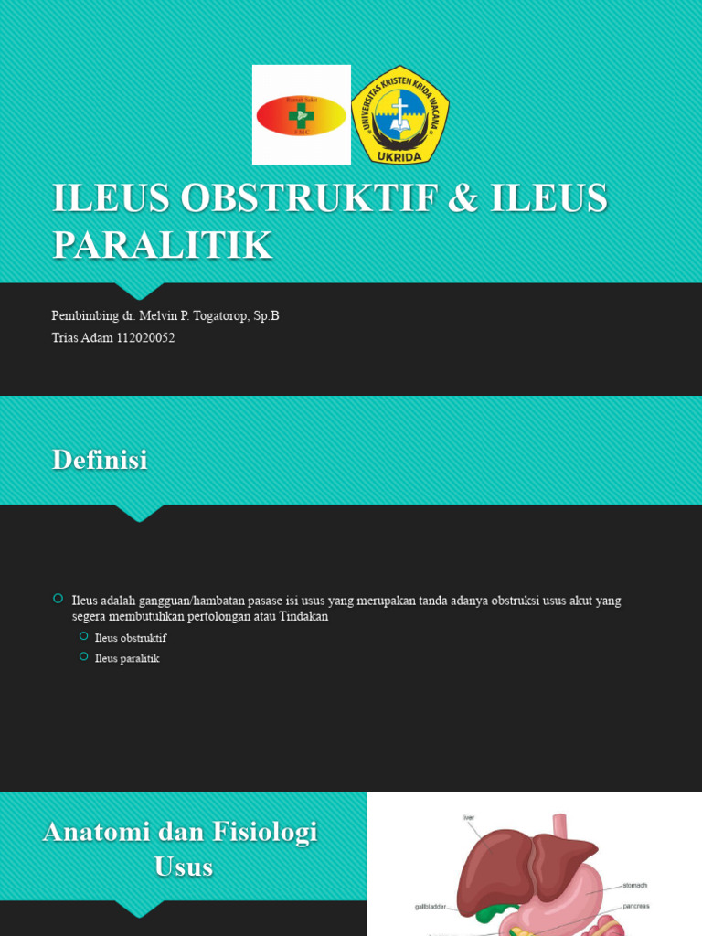 Ileus Obstruktif | PDF