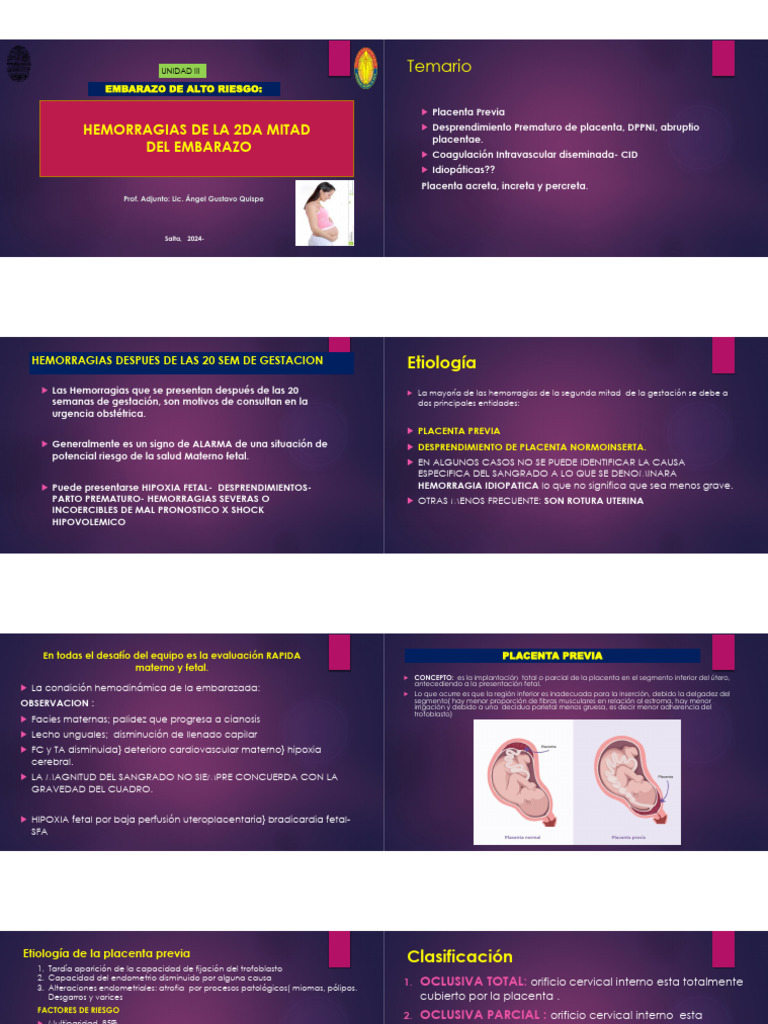 Hemorragia 2do Tri | PDF | El embarazo | Placenta