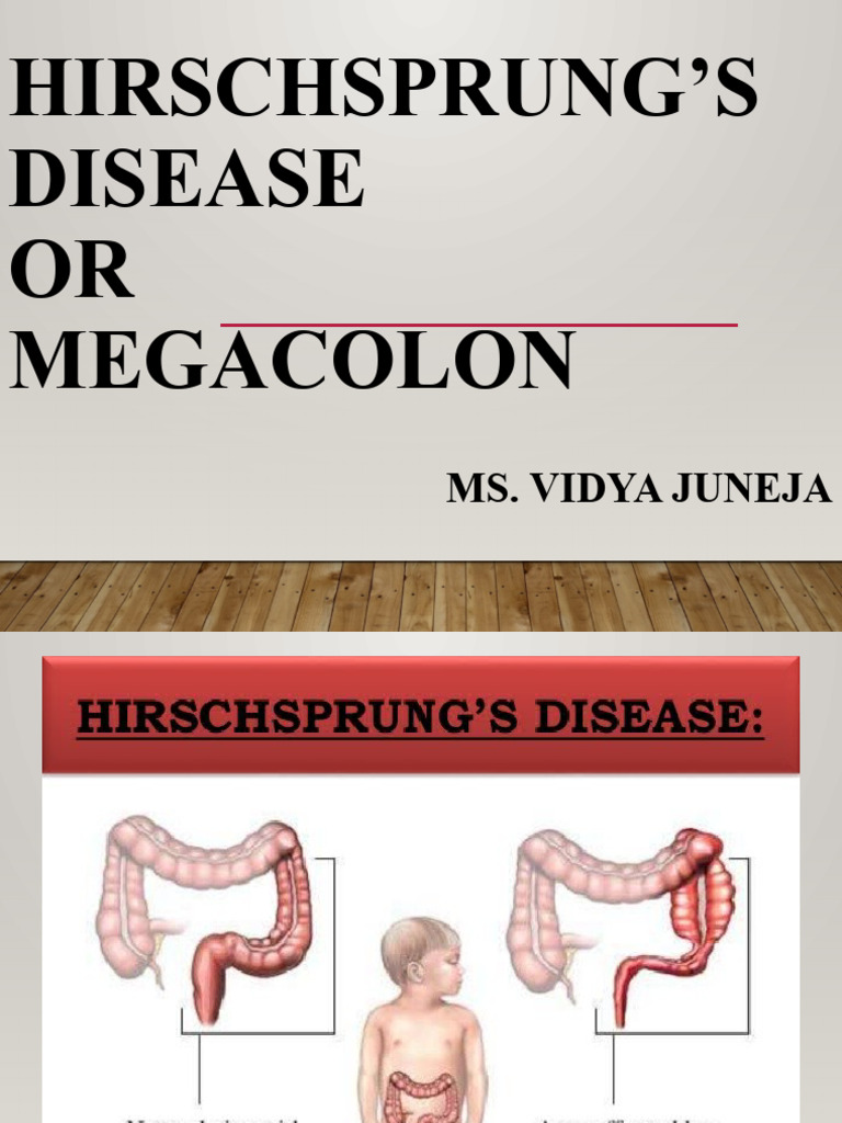 Hirschsprung Disease | PDF | Large Intestine | Gastroenterology