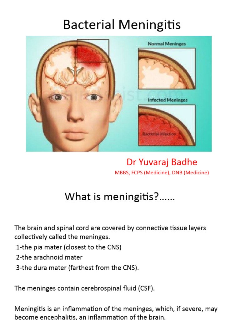 20 Bacterial Meningitis | PDF | Meningitis | Causes Of Death