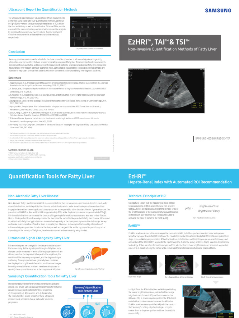 Tech Leaflet - Liver Qunatification Tools For Fatty Liver | PDF | Attenuation | Medical Ultrasound