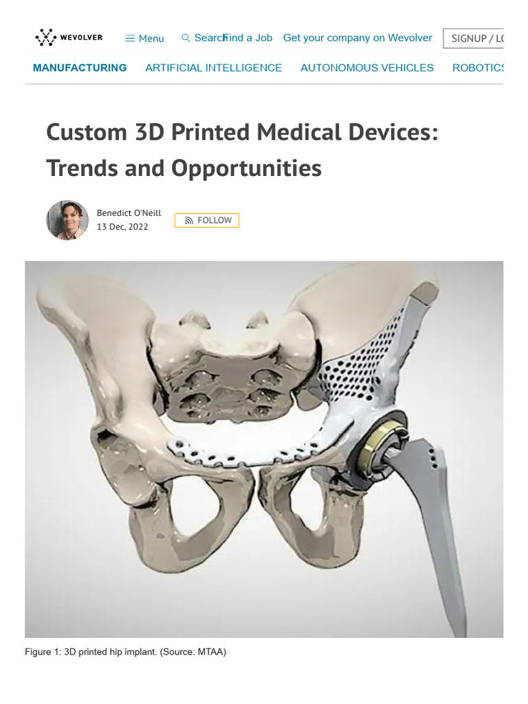 Custom 3D Printed Medical Devices - Trends and Opportunities | PDF | 3 D Printing | Implant ...