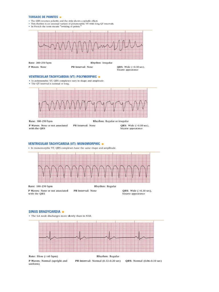 Ekg | PDF