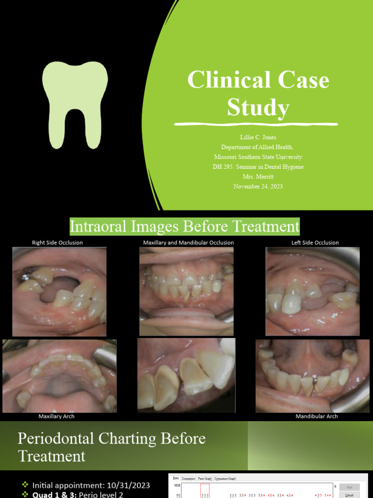 Clinical Case Study 3 | Download Free PDF | Dieting | Periodontology