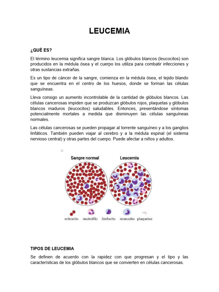 LEUCEMIA | PDF | Leucemia | Leucocito