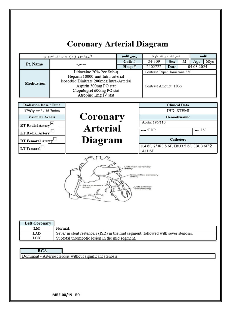 Primary PCI To LAD and LCX | PDF | Percutaneous Coronary Intervention ...