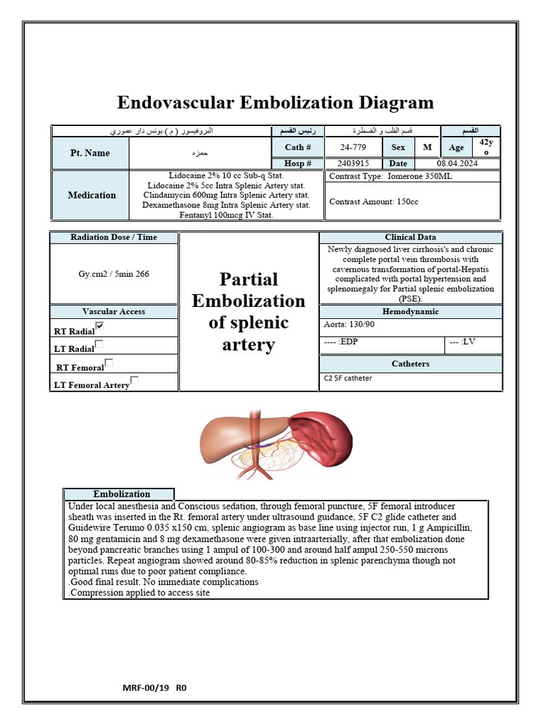 Partial Embolization of Splenic Artery | PDF | Angiography ...