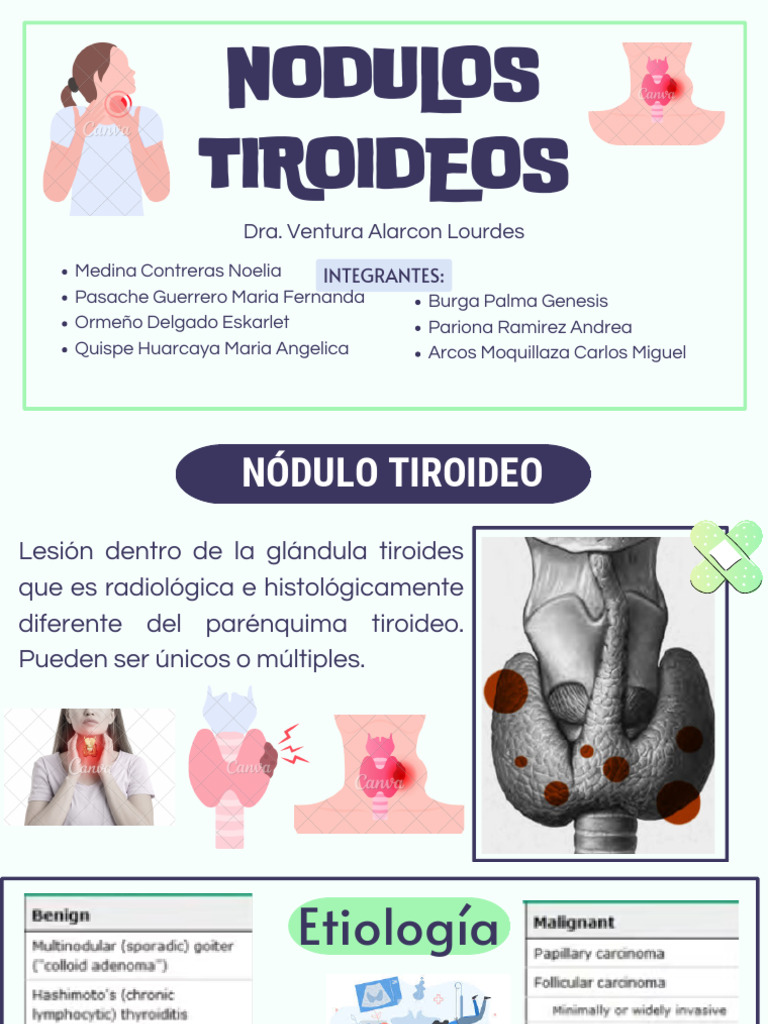 Nódulo Tiroideo | PDF | Tiroides | Endocrinología