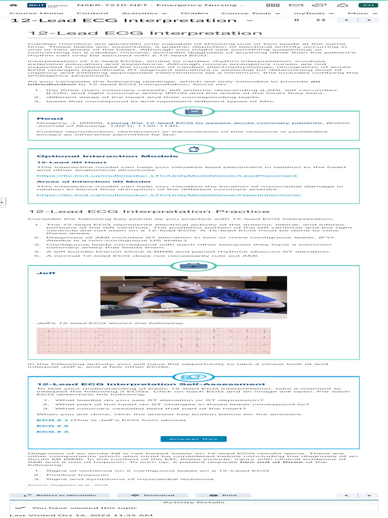 12-Lead ECG Interpretation Guide | PDF | Electrocardiography | Coronary ...