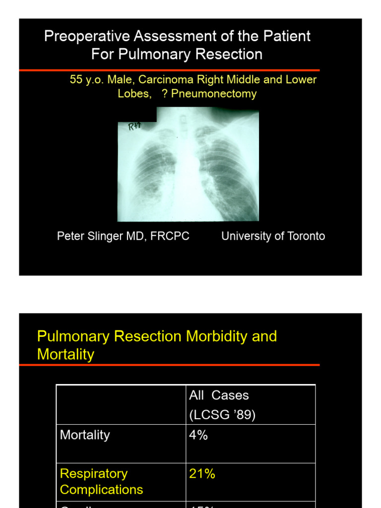 Pre Op for Lobectomy | PDF | Respiratory Diseases | Smoking Cessation