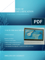 Alcon Legion Phaco System | PDF