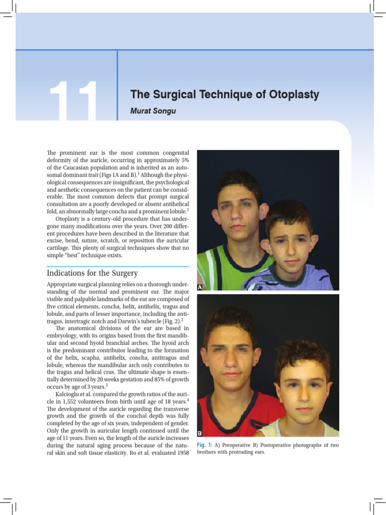 Otoplasty Surgical Techniques Guide | PDF | Anesthesia | Human Anatomy