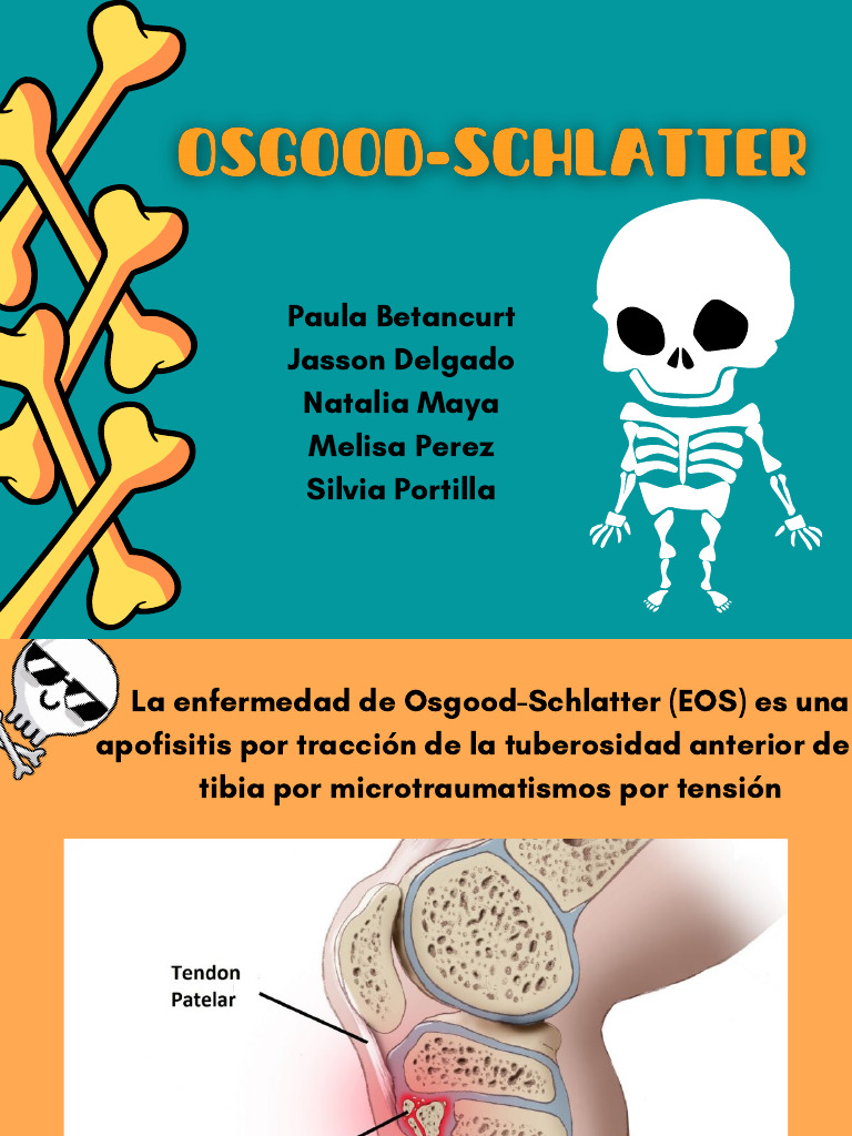 Osgood Schlatter | Descargar gratis PDF | Rodilla | Medicina CLINICA