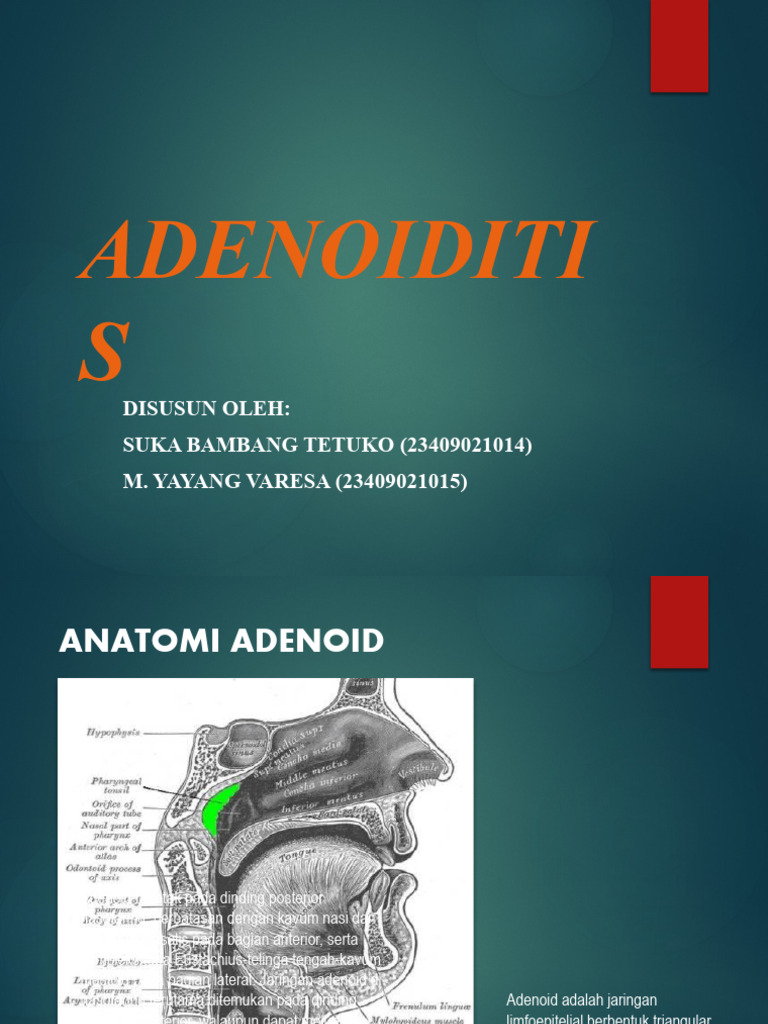 ADENOIDITIS-PPT Suka & Yayang | PDF