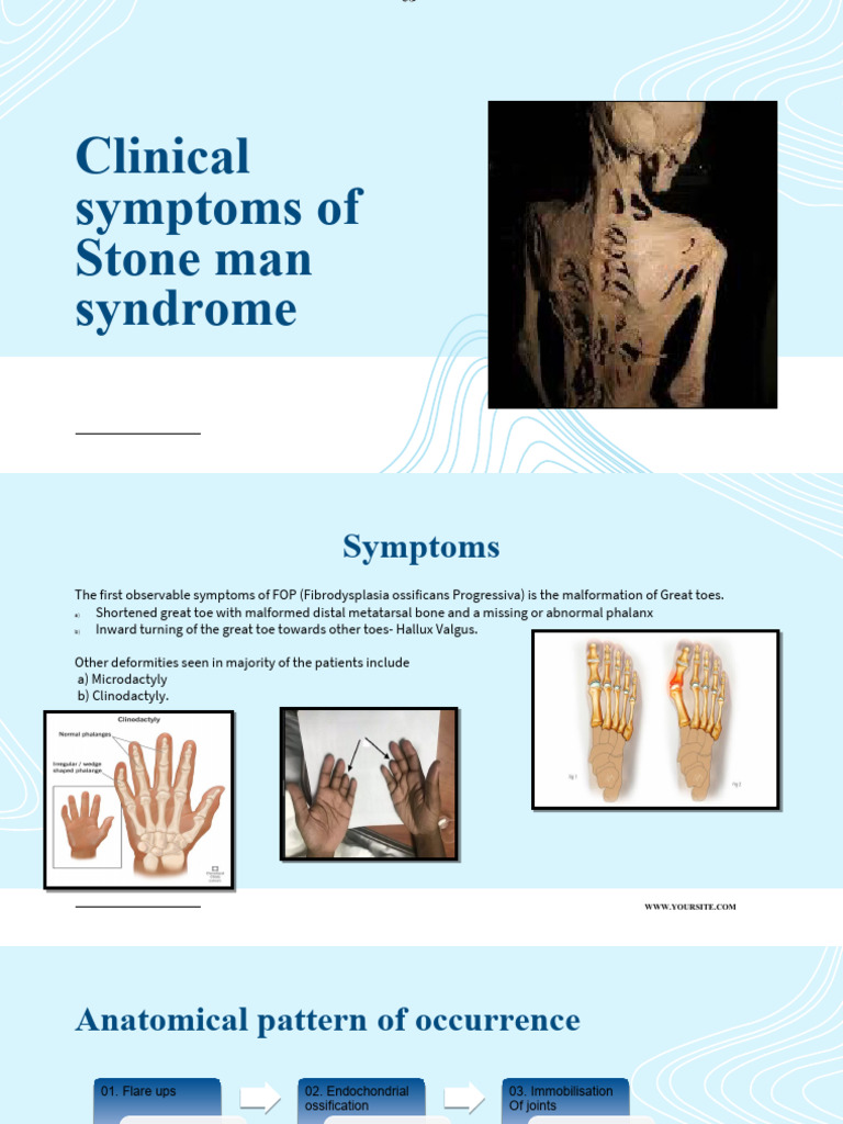 Symptoms and Impact of Stone Man Syndrome | PDF | Toe | Vertebral Column