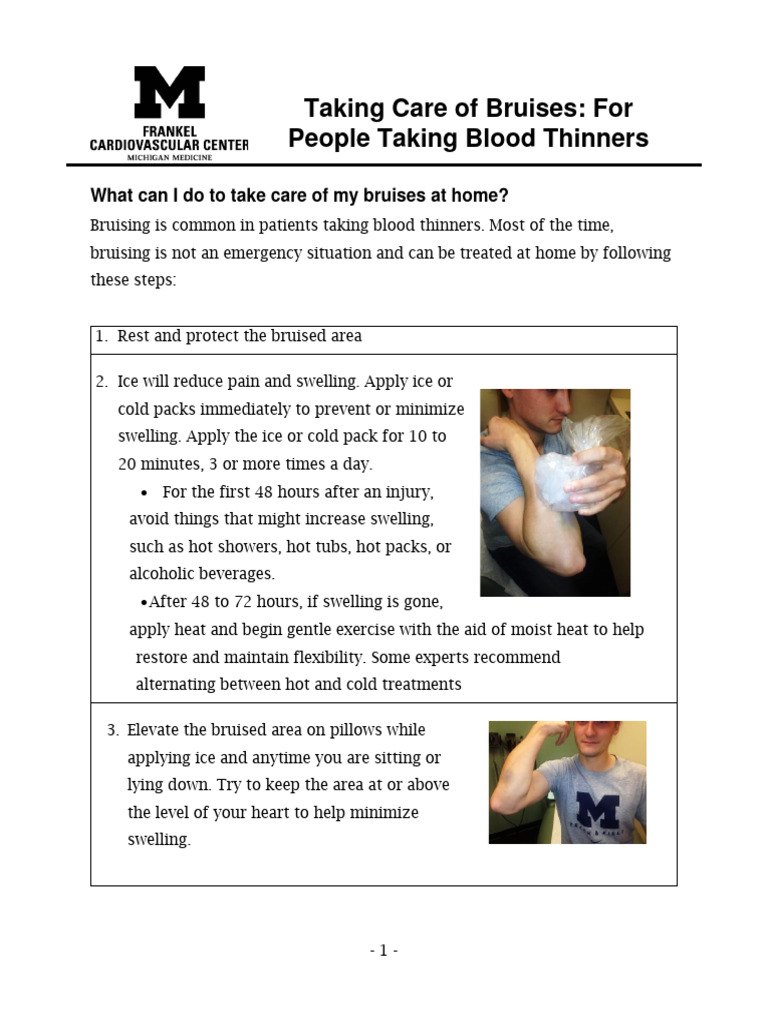 Bruises Blood Thinners | PDF | Medicine | Edema