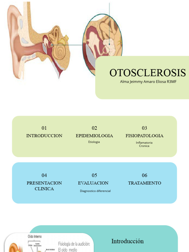 Otoesclerosis | PDF | Especialidades Medicas | Otorrinolaringología
