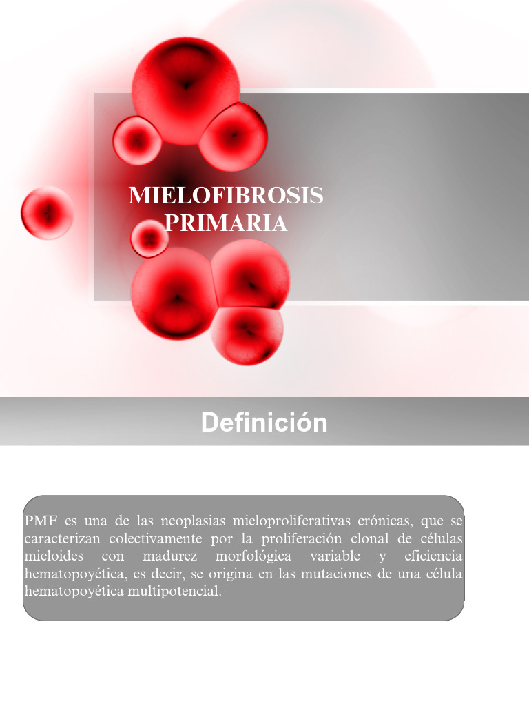 Mielofibrosis Primaria: Diagnóstico y Tratamiento | PDF | Hematología ...