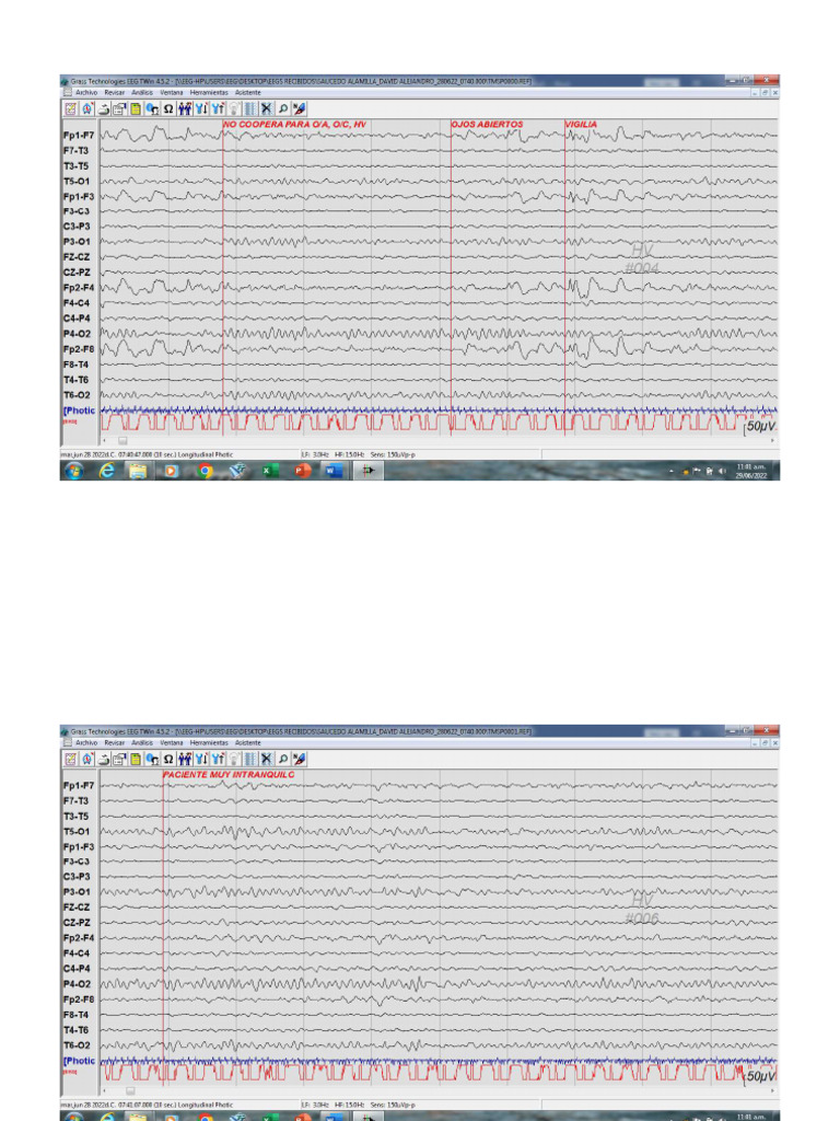 Saucedo Alamilla - David Alejandro - Eeg | PDF