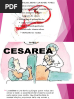Tipos de Incisiones en Cesárea | PDF | Parto | El embarazo