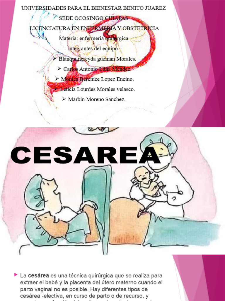 Cesárea Segmentaria Transperitoneal | PDF | Parto | Seccion de cesárea