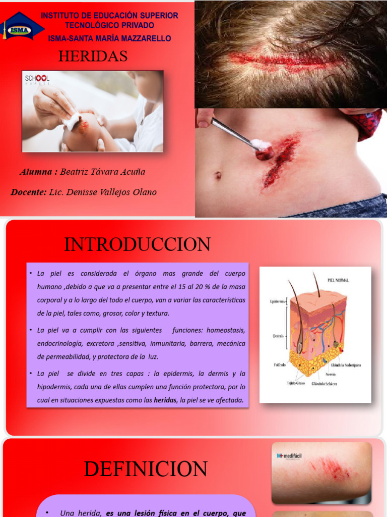 Heridas Resumen PDF | PDF | Piel | Herida