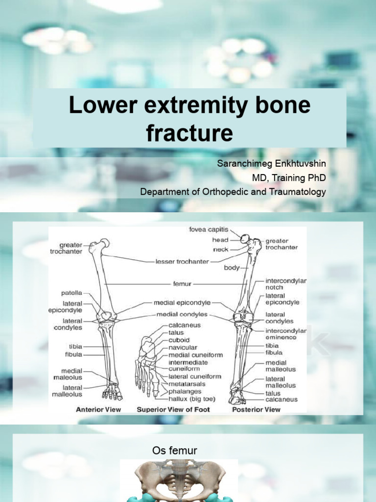 Lower Extremity Bone Fracture Lecture 3 | PDF | Knee | Clinical Medicine