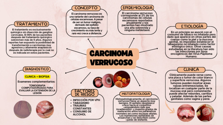 Carcinoma Verrucoso | PDF | Cáncer | Enfermedades y trastornos