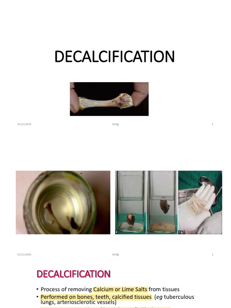 Week 9.2 Decalcification | PDF | Acid | Ethylenediaminetetraacetic Acid