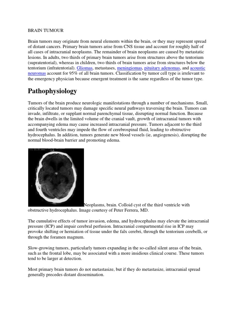 Pathophysiology: Gliomas Meningiomas Pituitary Adenomas Acoustic ...
