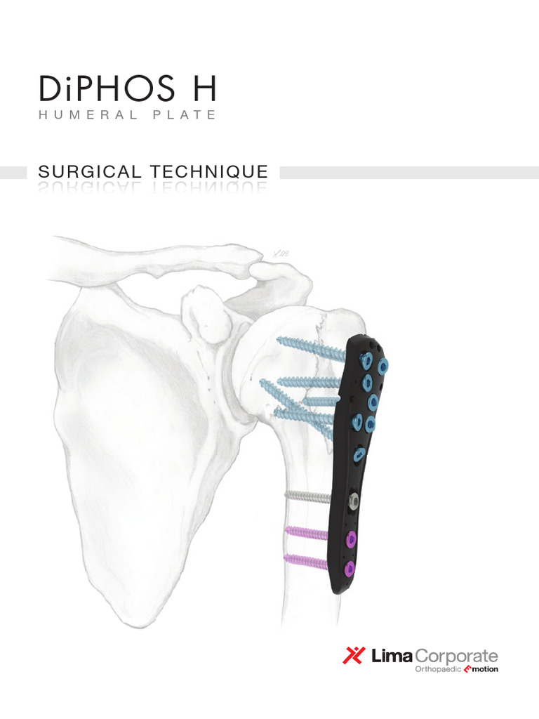 Diphos H | PDF | Screw | Surgery