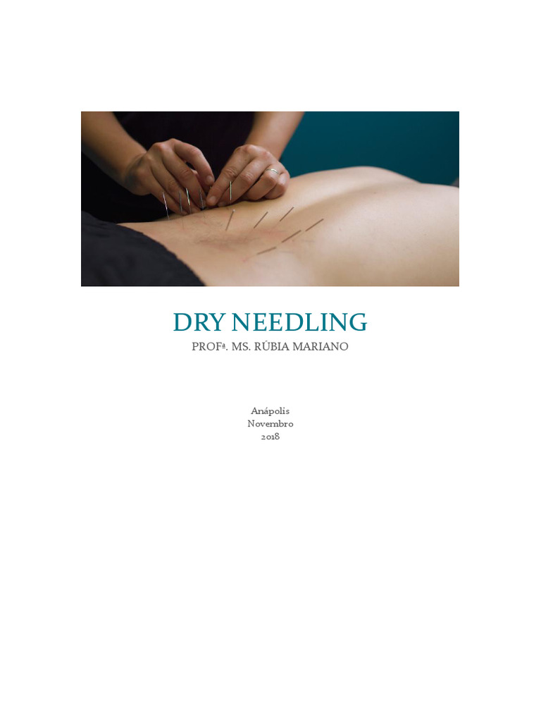 APOSTILA DRY NEEDLING Prof . Rúbia Novo | PDF