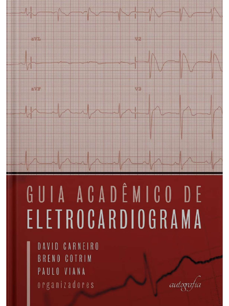 GUIA ACADÊMICO DE ECG - David Carneiro | PDF