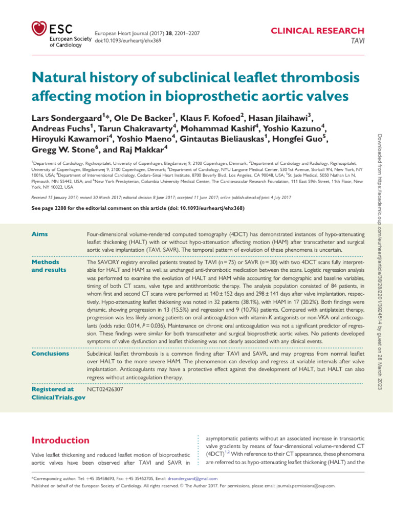Historia de La TVS | PDF | Diastole | Ct Scan