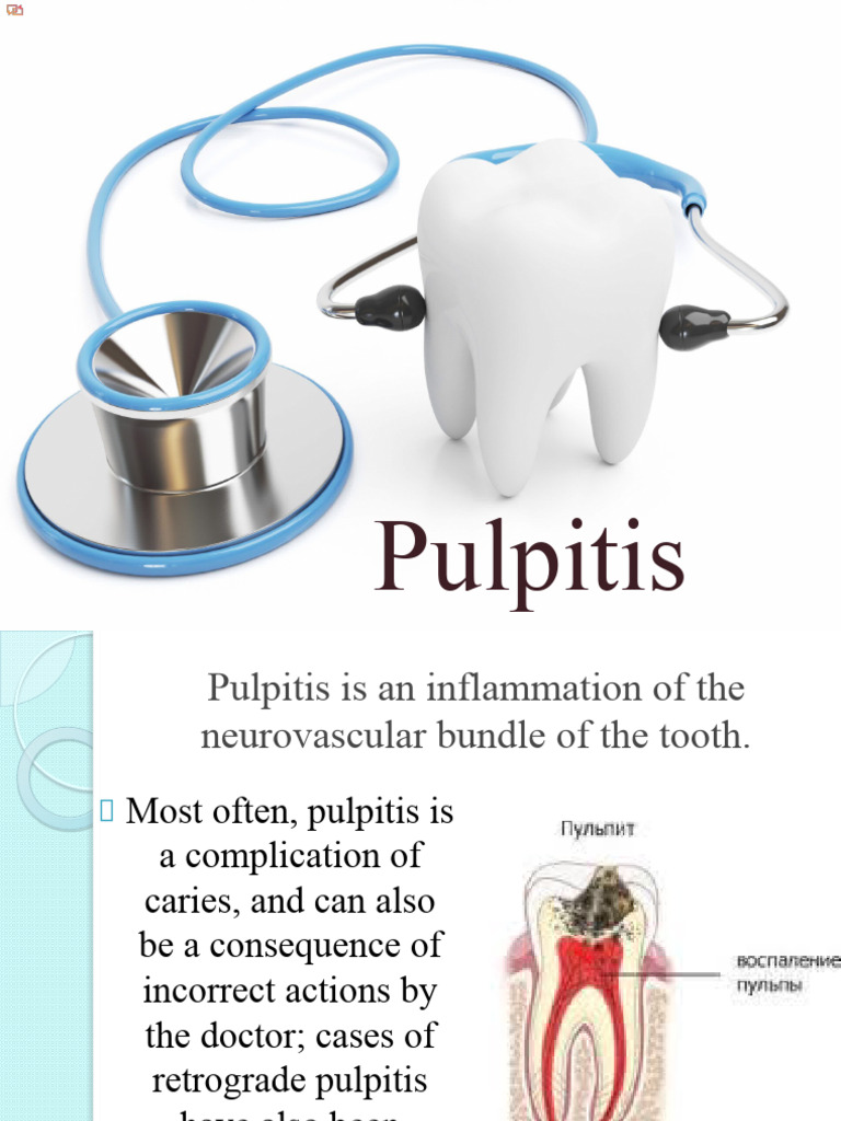 Pulpitis | PDF | Causes Of Death | Dental Anatomy
