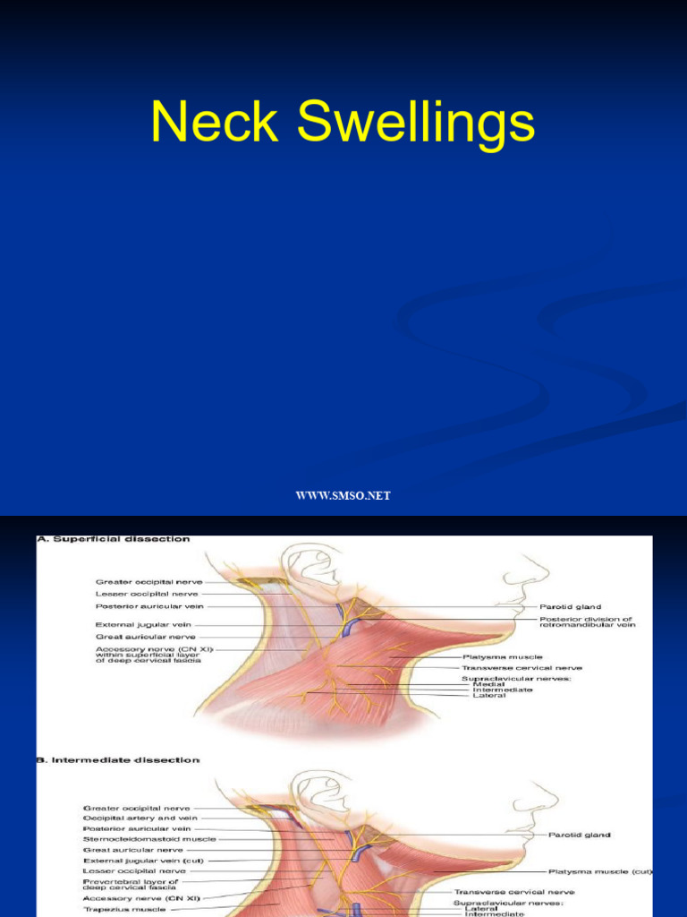 Neck Swellings | PDF | Medical Specialties | Diseases And Disorders