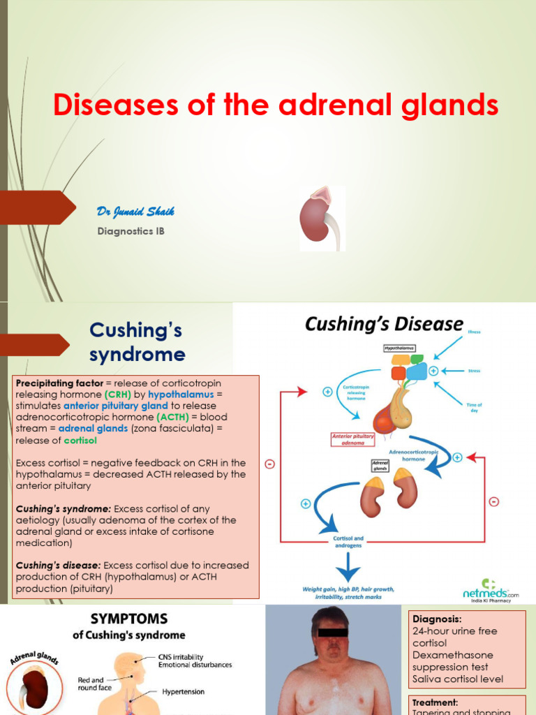 Diseases Of The Adrenal Glands Pdf Adrenal Gland