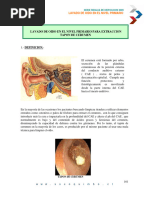 Guía Orl Cerumen Impactado | PDF | Oído | Sonido