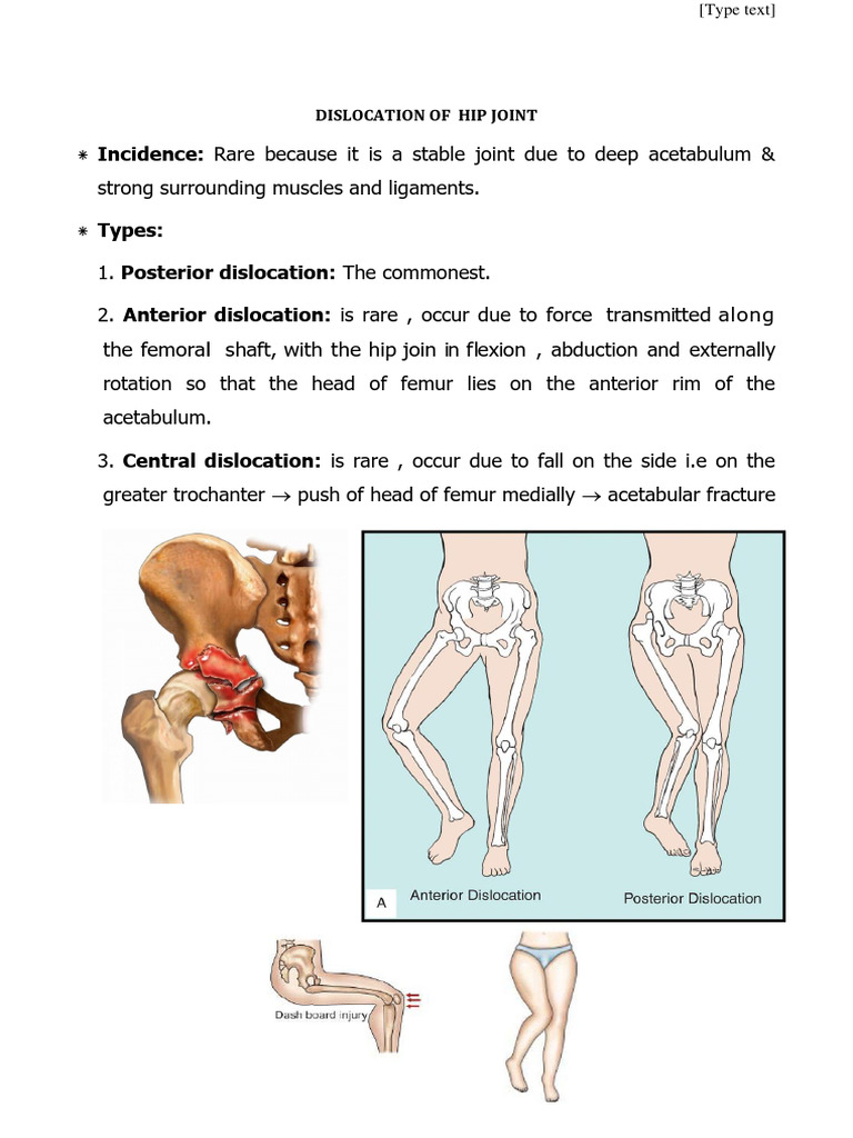 Hip Joint Dislocation and Fractures Guide | PDF | Hip | Anatomical ...