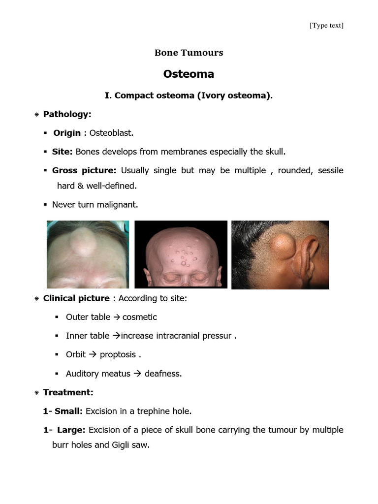 Bone Tumours Pdf Bone Neoplasms