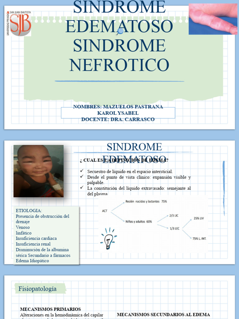 Síndrome Edematoso y Nefrótico en Niños | PDF | Edema | Enfermedades y ...
