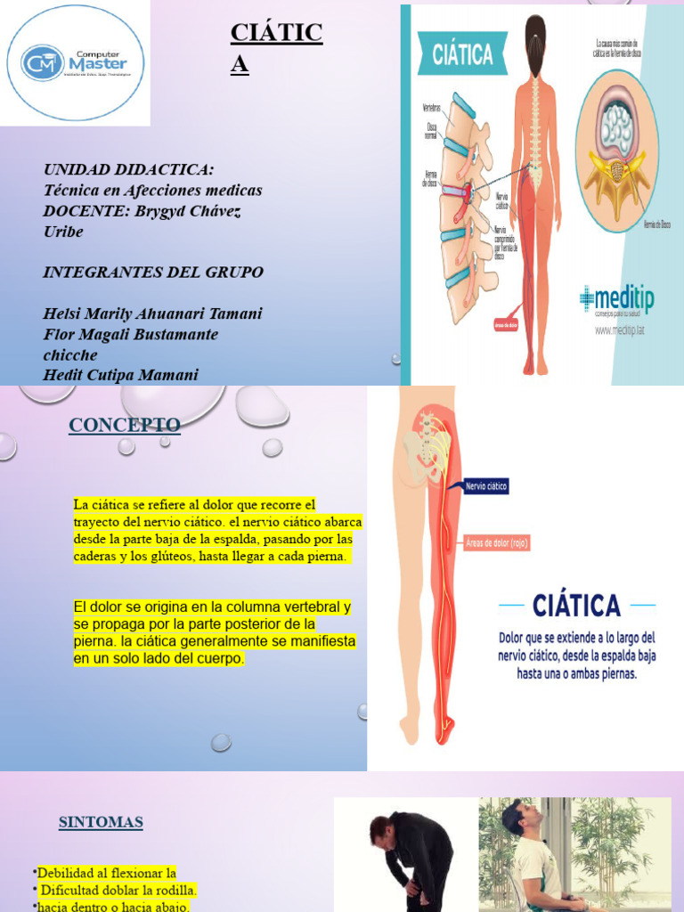 CIÁTICA | PDF | Dolor lumbar | Medicina CLINICA