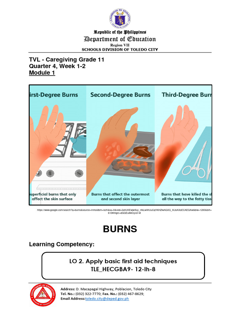 Grade 11 Quarter4 Module 1 Burns Final | PDF | Burn | Skin