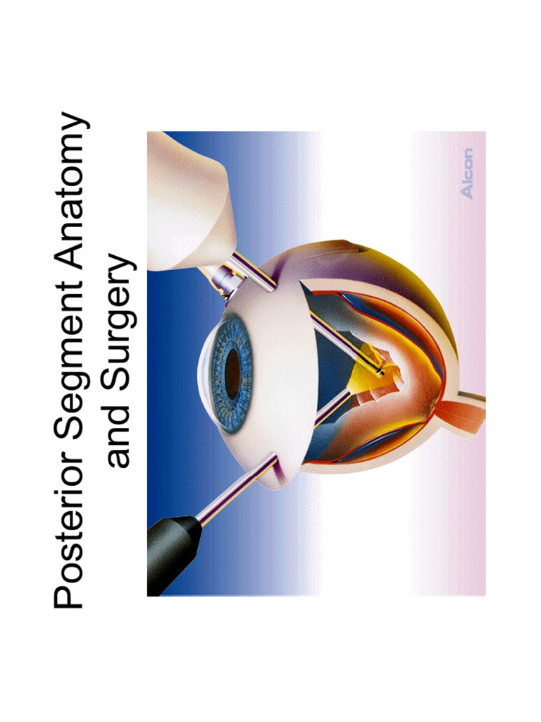 Accurus - Anatomy & Product Overview | PDF | Retina | Cornea