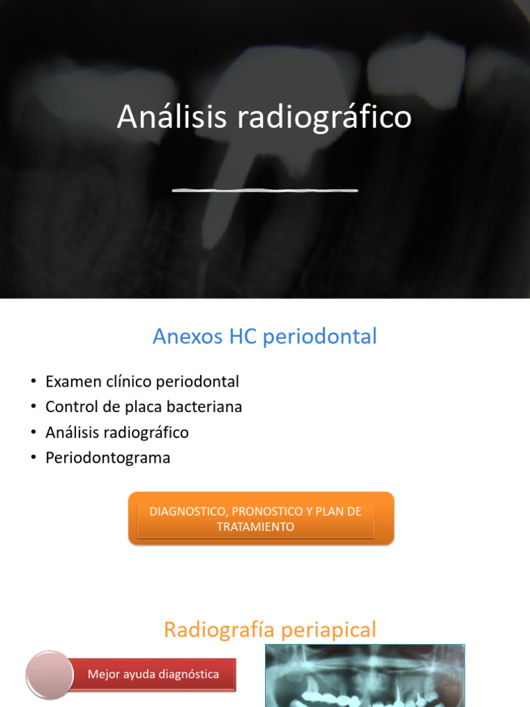 Analisis Radiografico 7 | PDF | Esmalte de dientes | Boca