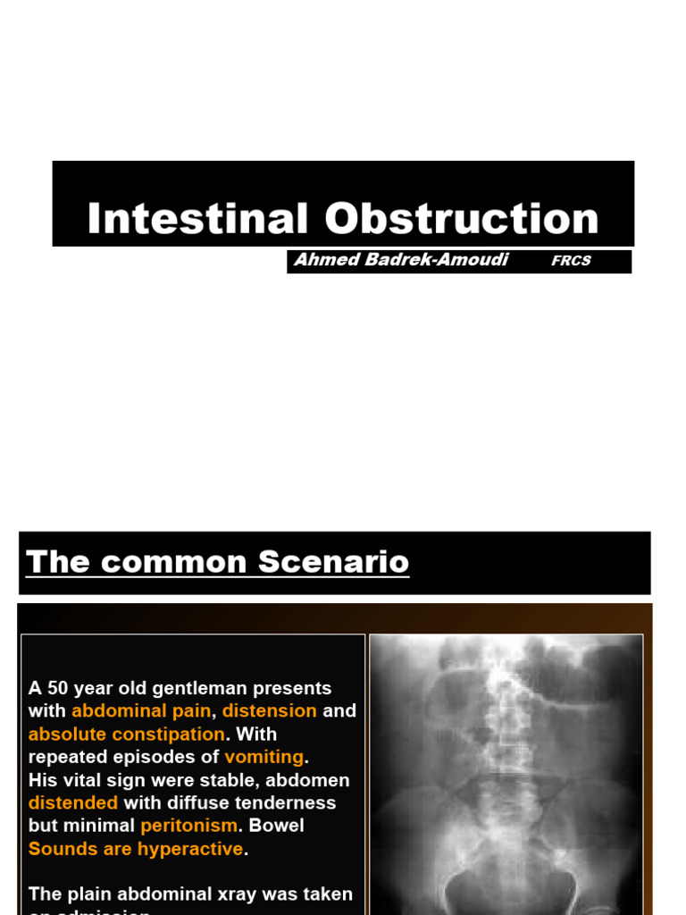 Intestinal Obstruction Guide | PDF | Digestive Diseases | Clinical Medicine