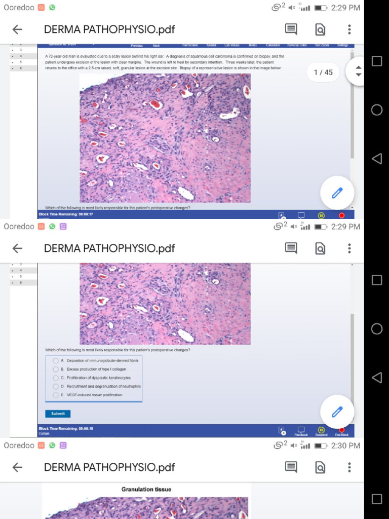 Wound Healing Questions | PDF