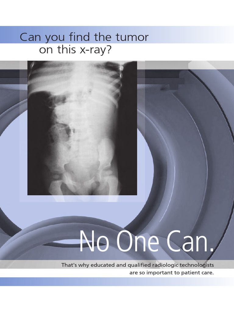 Advocacy Brochure | PDF | Radiology | Medical Imaging