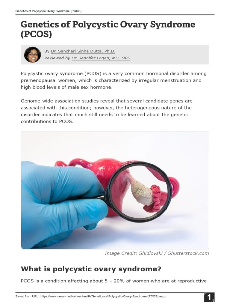 Genetics of Polycystic Ovary Syndrome (PCOS) | PDF | Polycystic Ovary ...