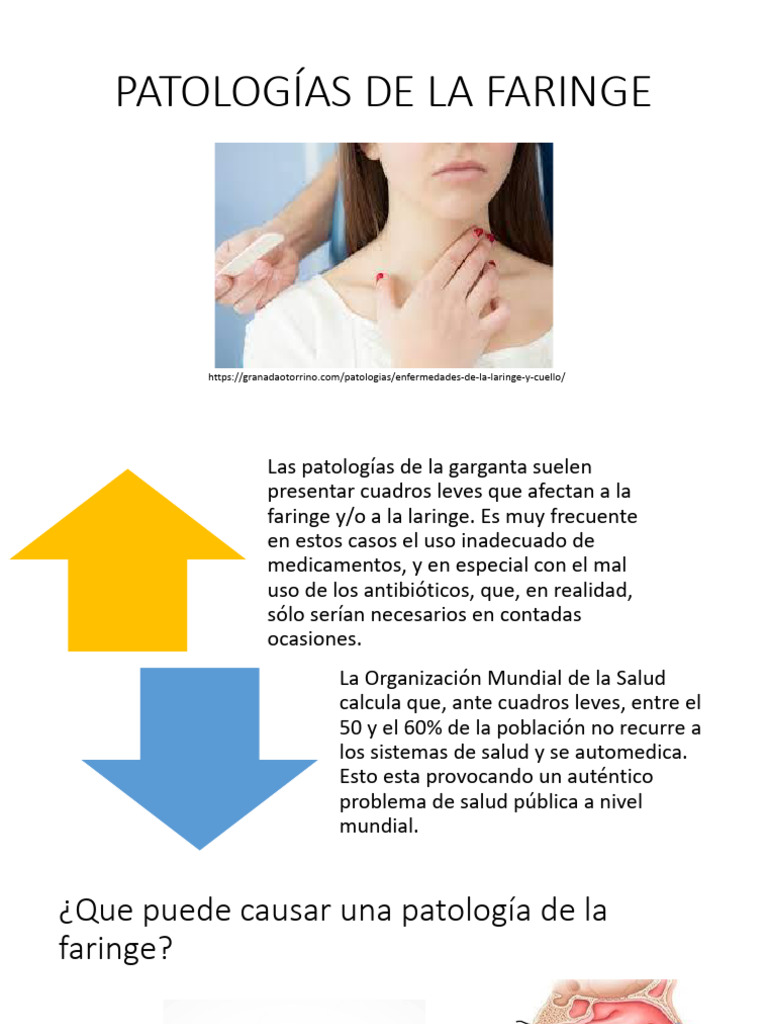 Patologias de La Faringe | PDF | Cáncer | Causas de la muerte